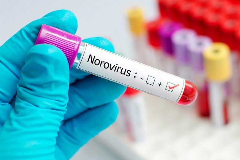 norovirus - Pedijatar.mk